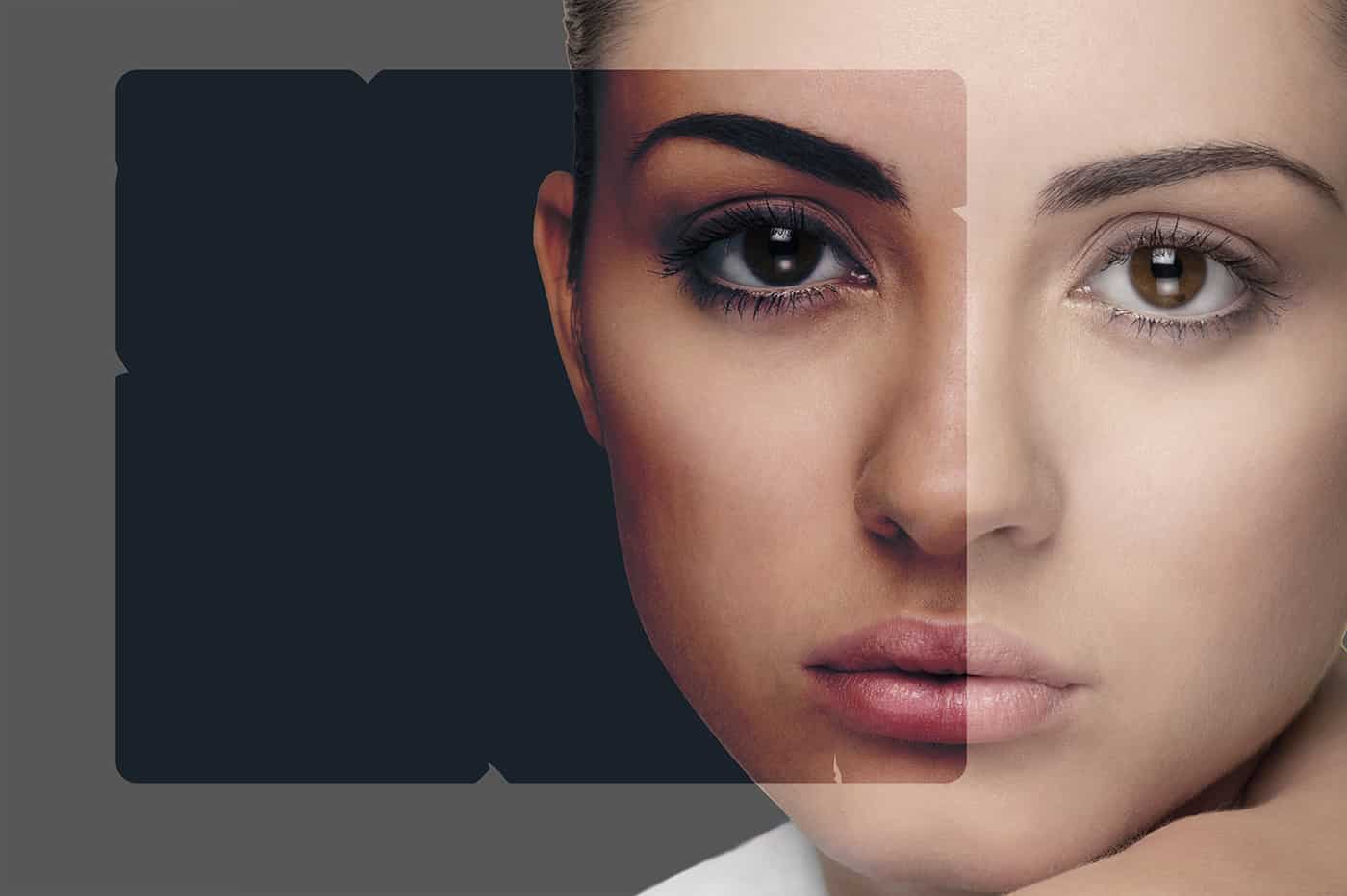 How to Get Hyperpigmentation Off Your Skin?